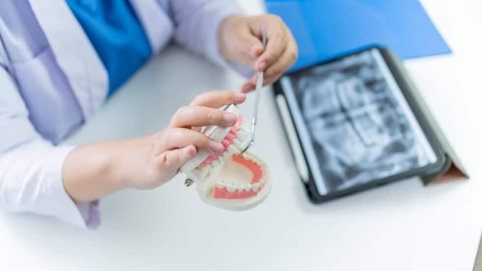 How to Fix Rotten Teeth